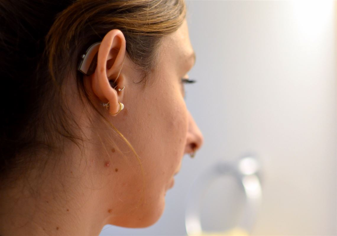 I Have Hearing Loss The New Over the counter Hearing Aids Won t Work