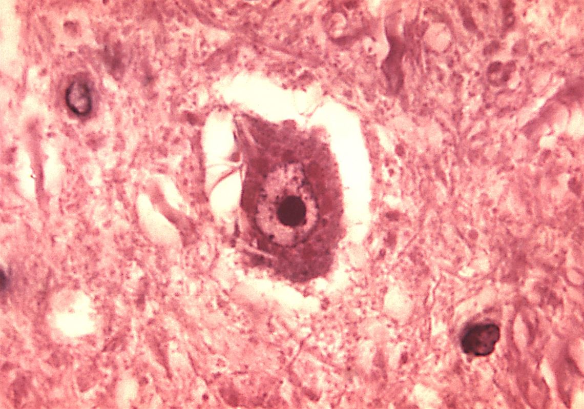 Rabies is a less of a threat but isn't going anywhere | Pittsburgh Post ...